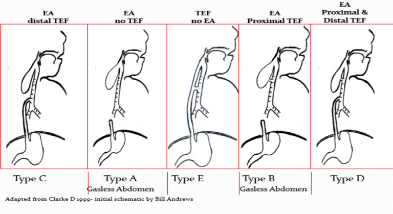 Neonatal Surgery - Toronto Centre for Neonatal Health